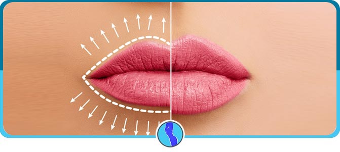 Lip Enhancement Treatment Clinic Near Me in Fairfax VA